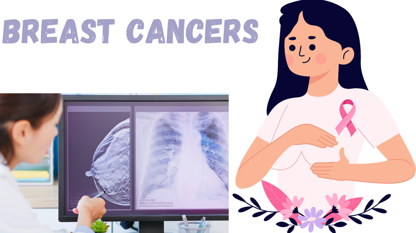 Breast cancer 100%